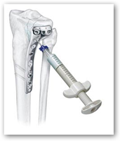 At Norian Four Executives Charged in Connection With Unlawful Clinical ...